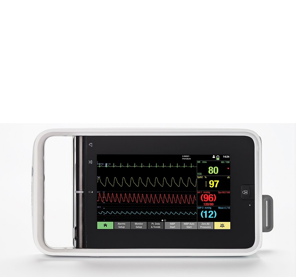 Monitoraggio al posto letto |Migliora il processo decisionale ...