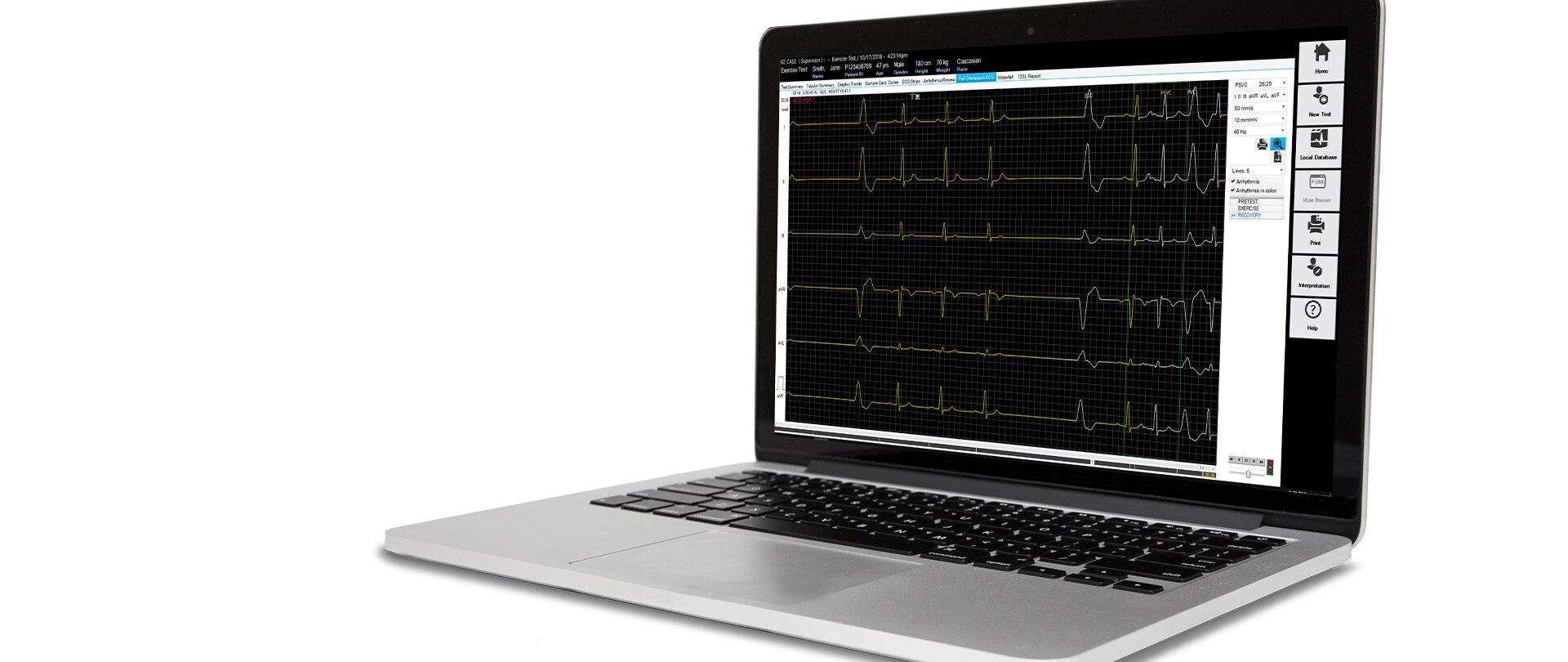 CardioSoft-v7-sp7 | GE HealthCare (Italy)