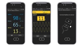 Portrait™ Mobile | GE HealthCare (Italy)