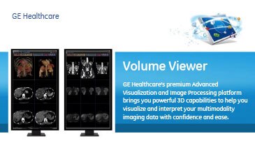 Volume Viewer | GE Healthcare