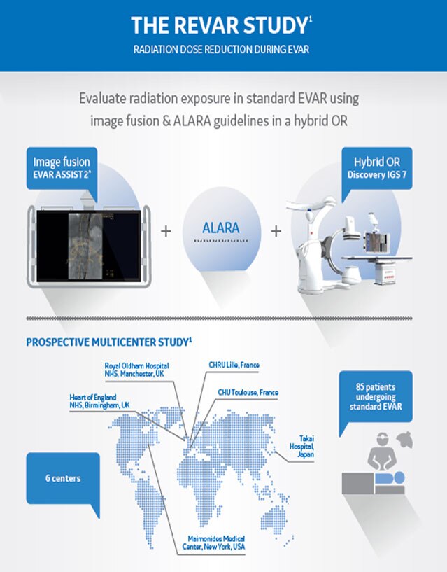 Discovery IGS 7 per sale operatorie ibride | GE Healthcare