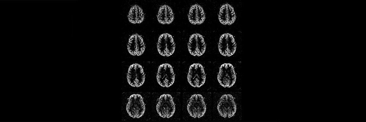 3D ASL | GE HealthCare (Italy)