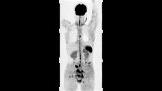 eDWI | GE HealthCare (Italy)